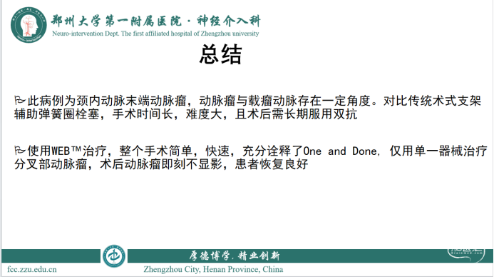 全麻下右侧颈内动脉末端动脉瘤web瘤内扰流装置植入术