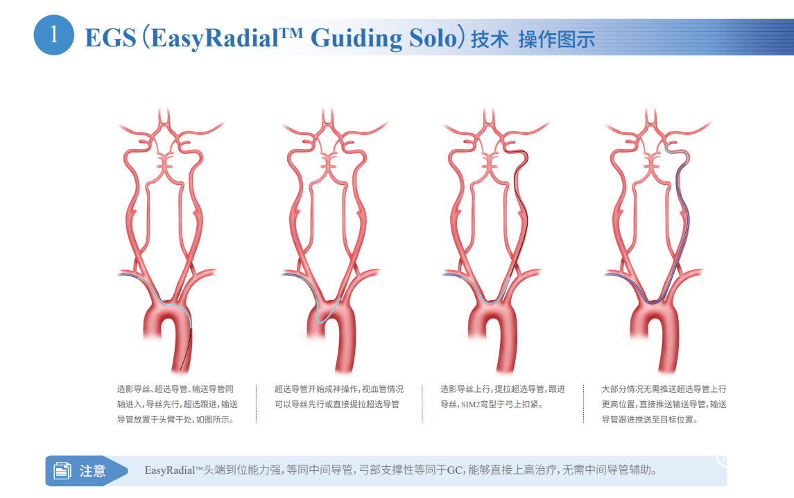Easyradial经桡专用导管标准操作模拟演示