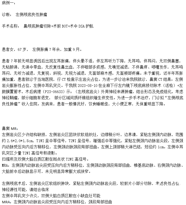 中国中西医结合学会耳鼻咽喉科专业委员会第二届青年专题学术会 经口咽后淋巴结切除(备动脉预夹闭)颈淋巴结清扫 脑医汇 神外资讯